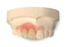Flipper | Partial Denture – Direct Dental Prosthetics