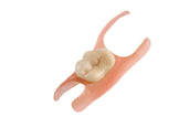 Nesbit | Partial Denture – Direct Dental Prosthetics