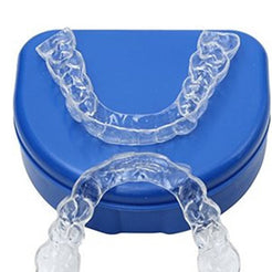 Custom Teeth Bleaching Trays – Direct Dental Prosthetics